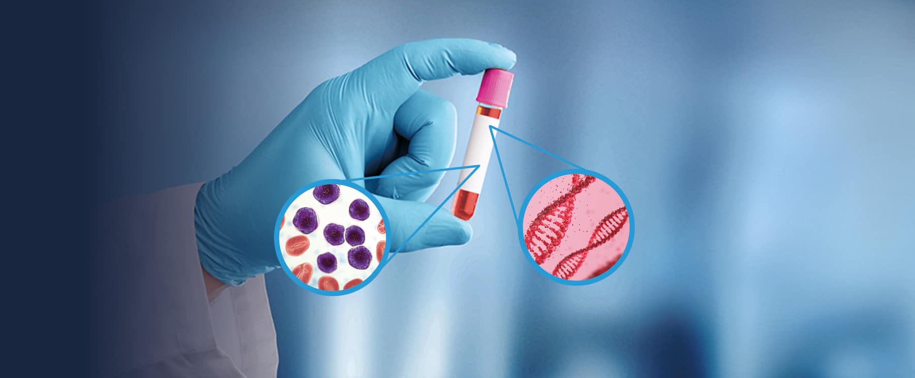 Potential to transform cancer care | ANGLE plc