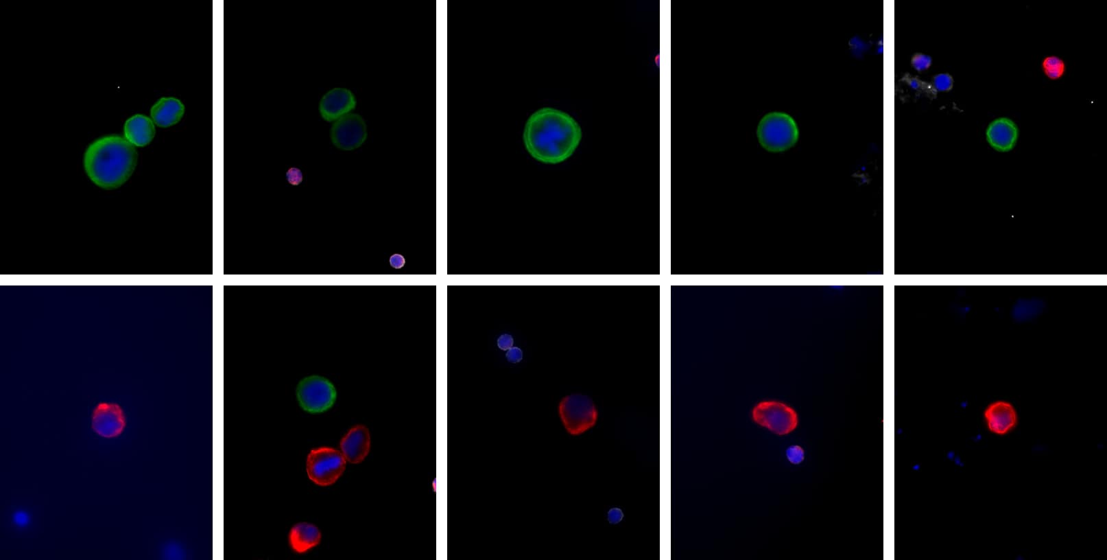 Portrait+ CTC Staining Kit | ANGLE plc